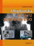 Alloplastyka stawu biodrowego - Andrzej Pozowski